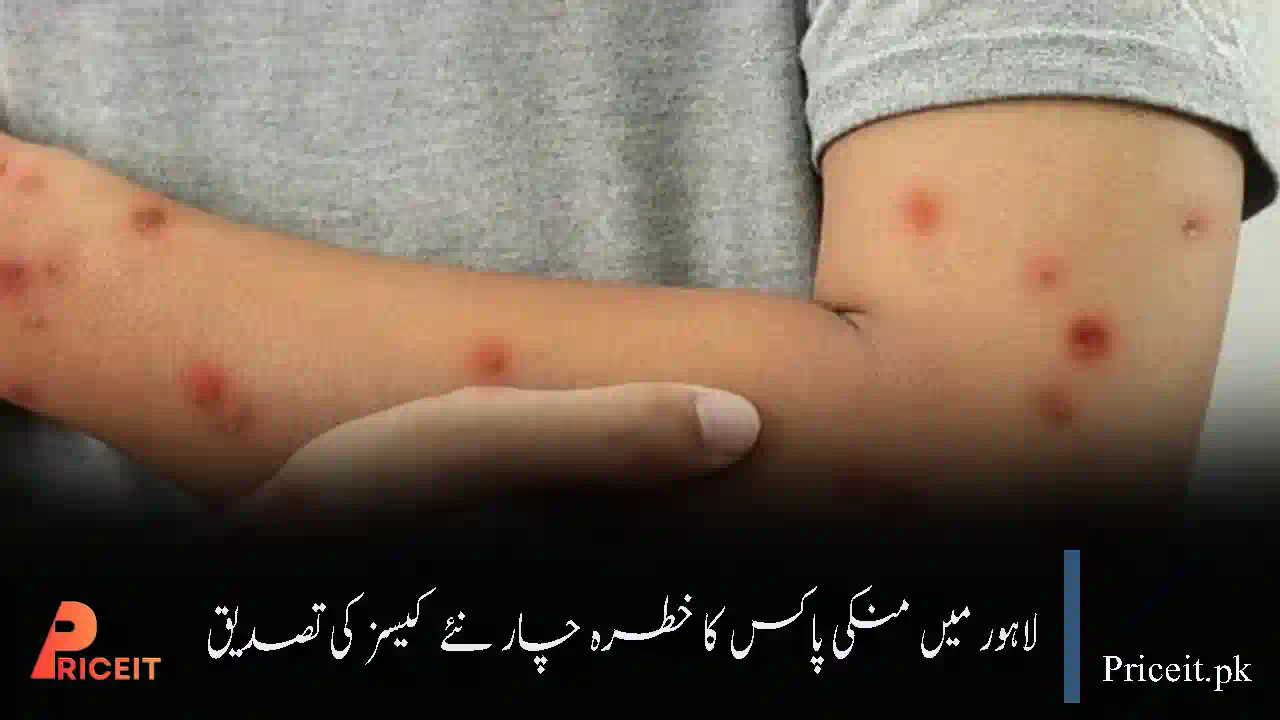 Monkeypox Threat in Lahore: Four New Cases Confirmed and Public Health ...